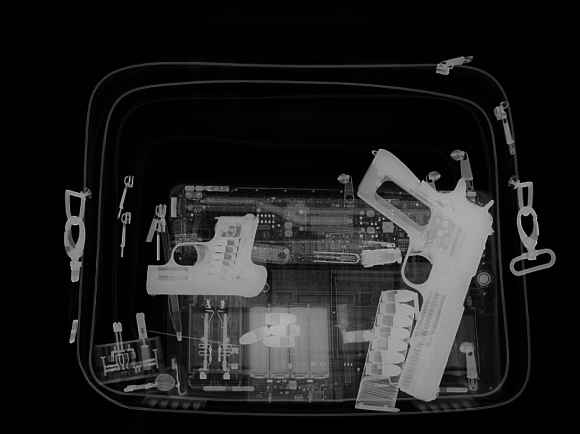 How to decode an x-ray image | ICM